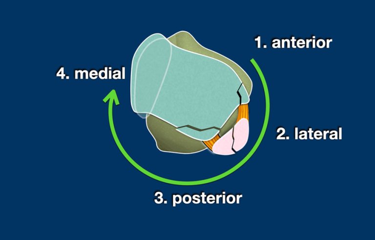 The Radiology Assistant : Algoritm for Ankle Fractures 2.0
