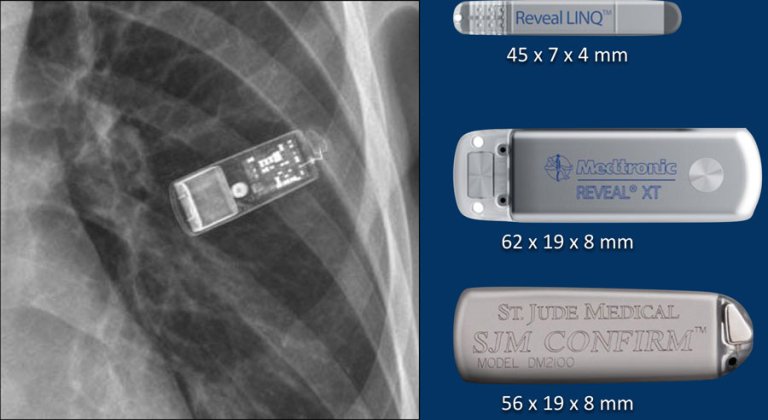 The Radiology Assistant : Cardiovascular devices