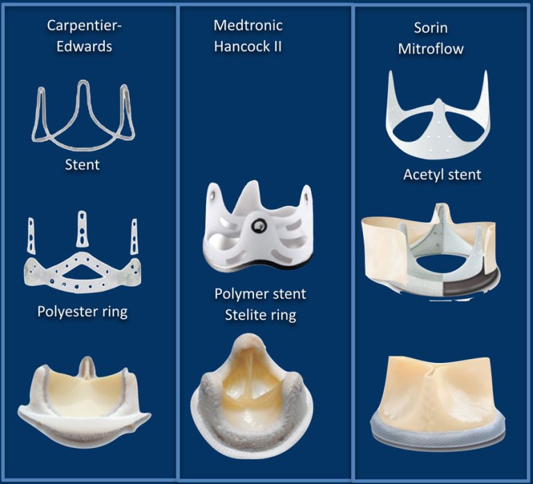 The Radiology Assistant : Cardiovascular devices