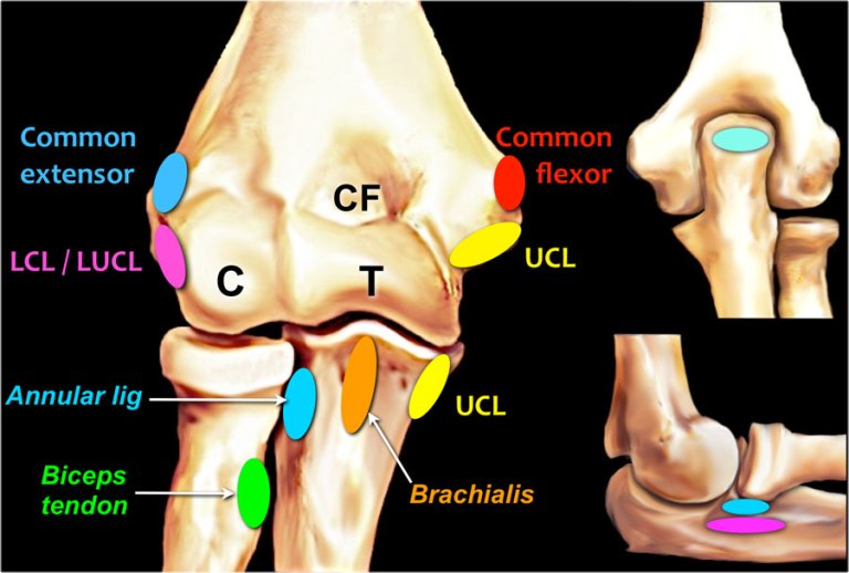 The Radiology Assistant : MRI examination of the Elbow